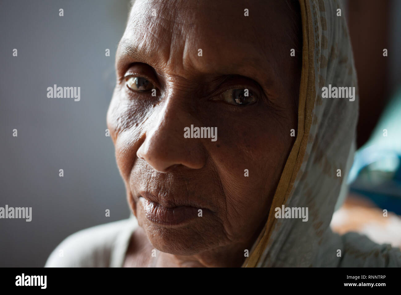 Living with leprosy hi-res stock photography and images - Alamy