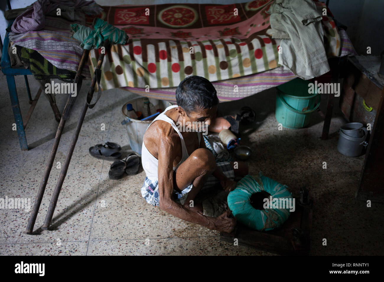 Eldry people who effected by leprosy living togather in a old care ...