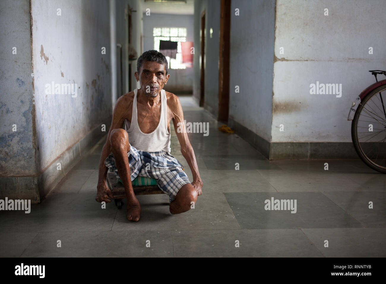 Eldry people who effected by leprosy living togather in a old care ...