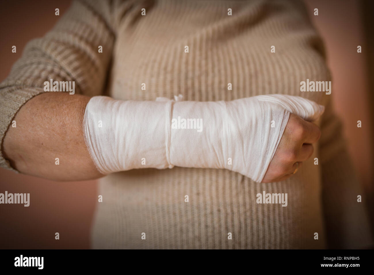 Orthopedic gypsum hi-res stock photography and images - Alamy