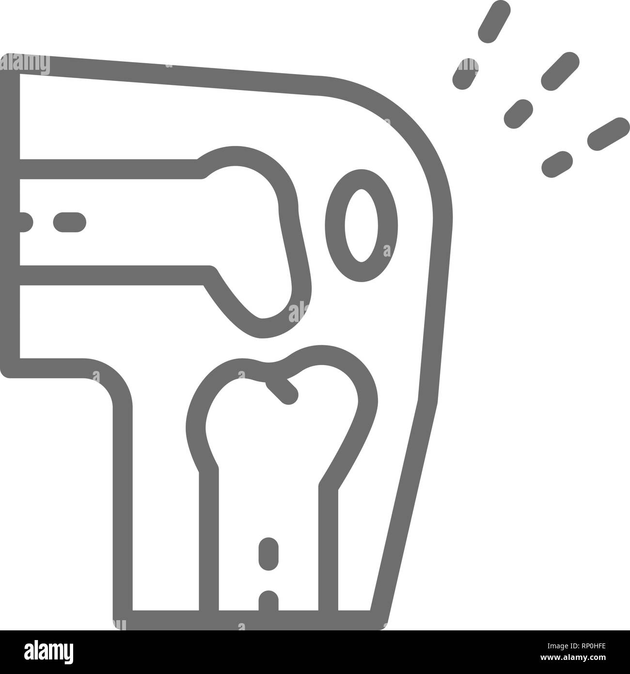 Arthritis knee joint Black and White Stock Photos & Images - Alamy