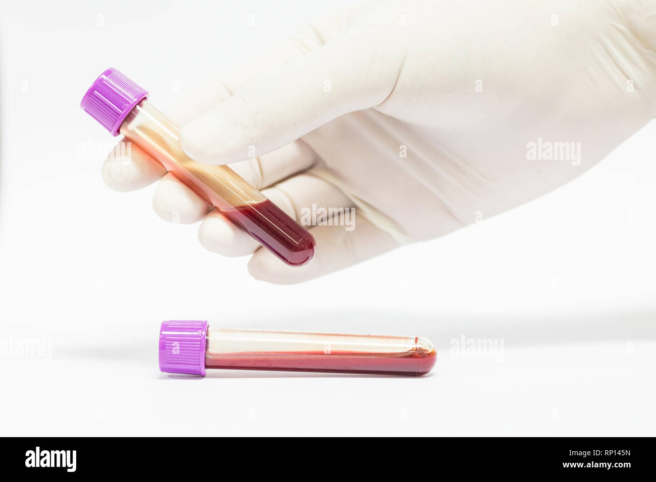 Medical technician holding Blood tube in Laboratory Stock Photo - Alamy