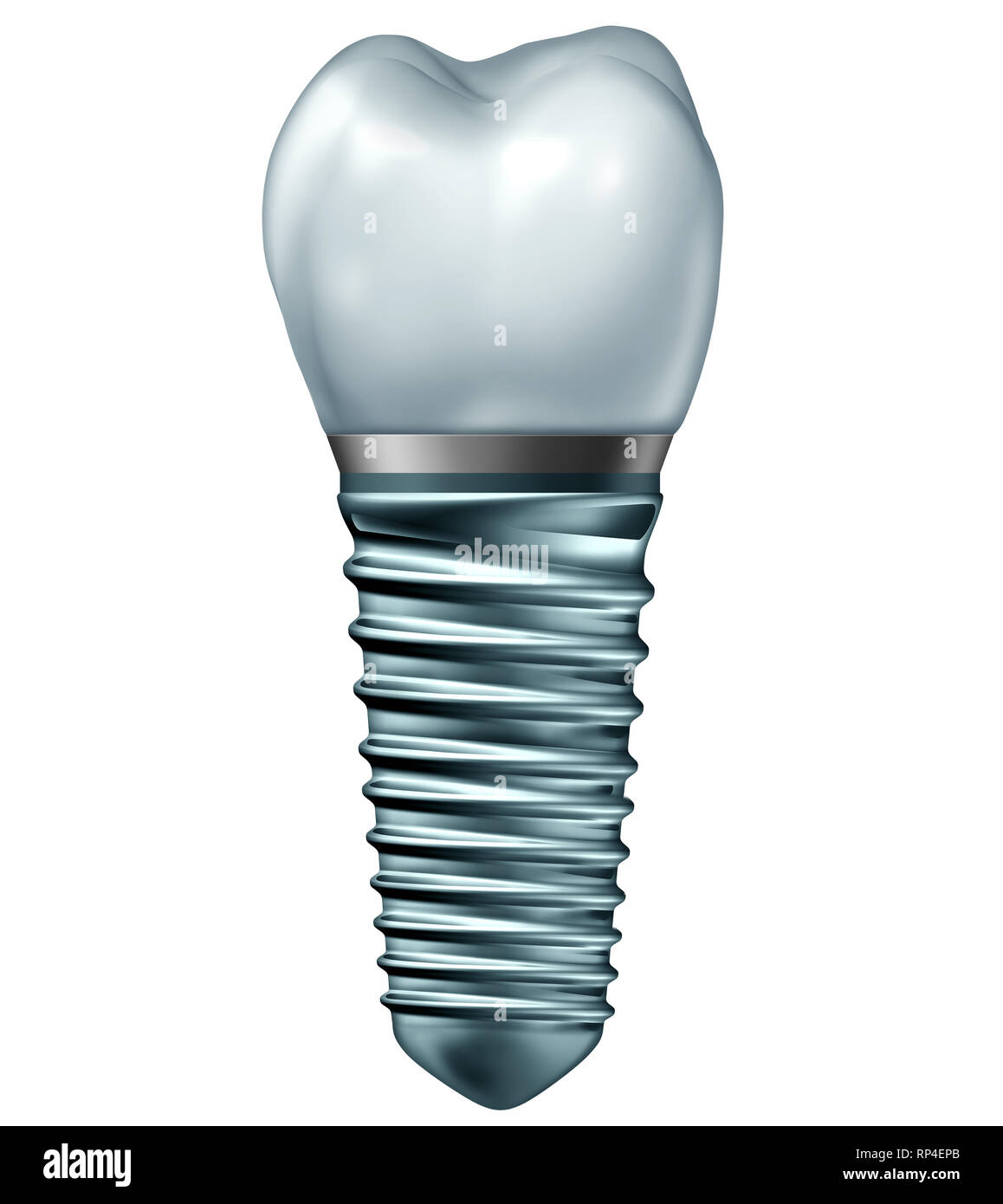 Dental Implant or endosseous tooth prosthetic with an orthodontic crown ...