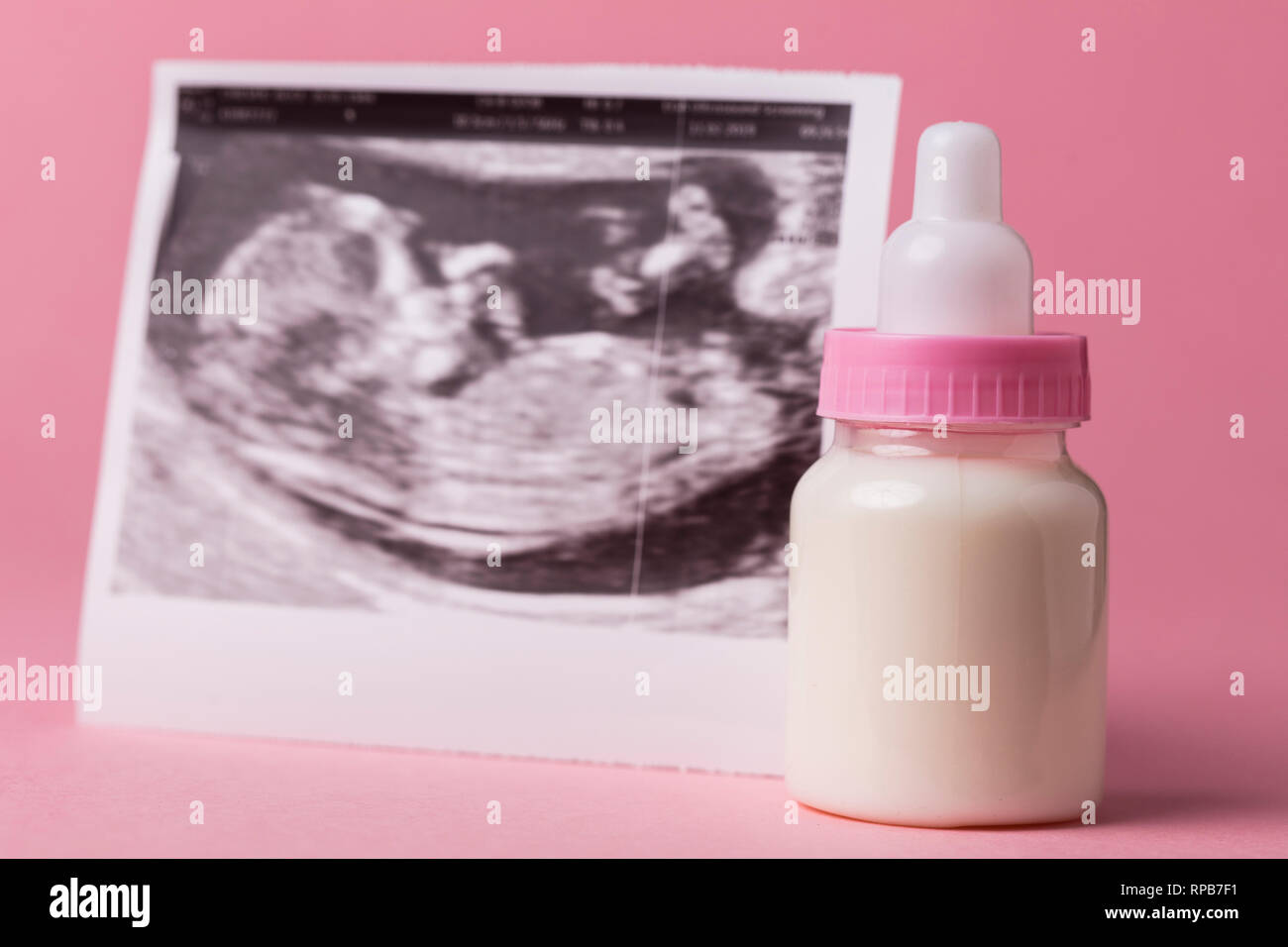 Baby scan ultrasound picture. Expectant parents concept Stock Photo - Alamy
