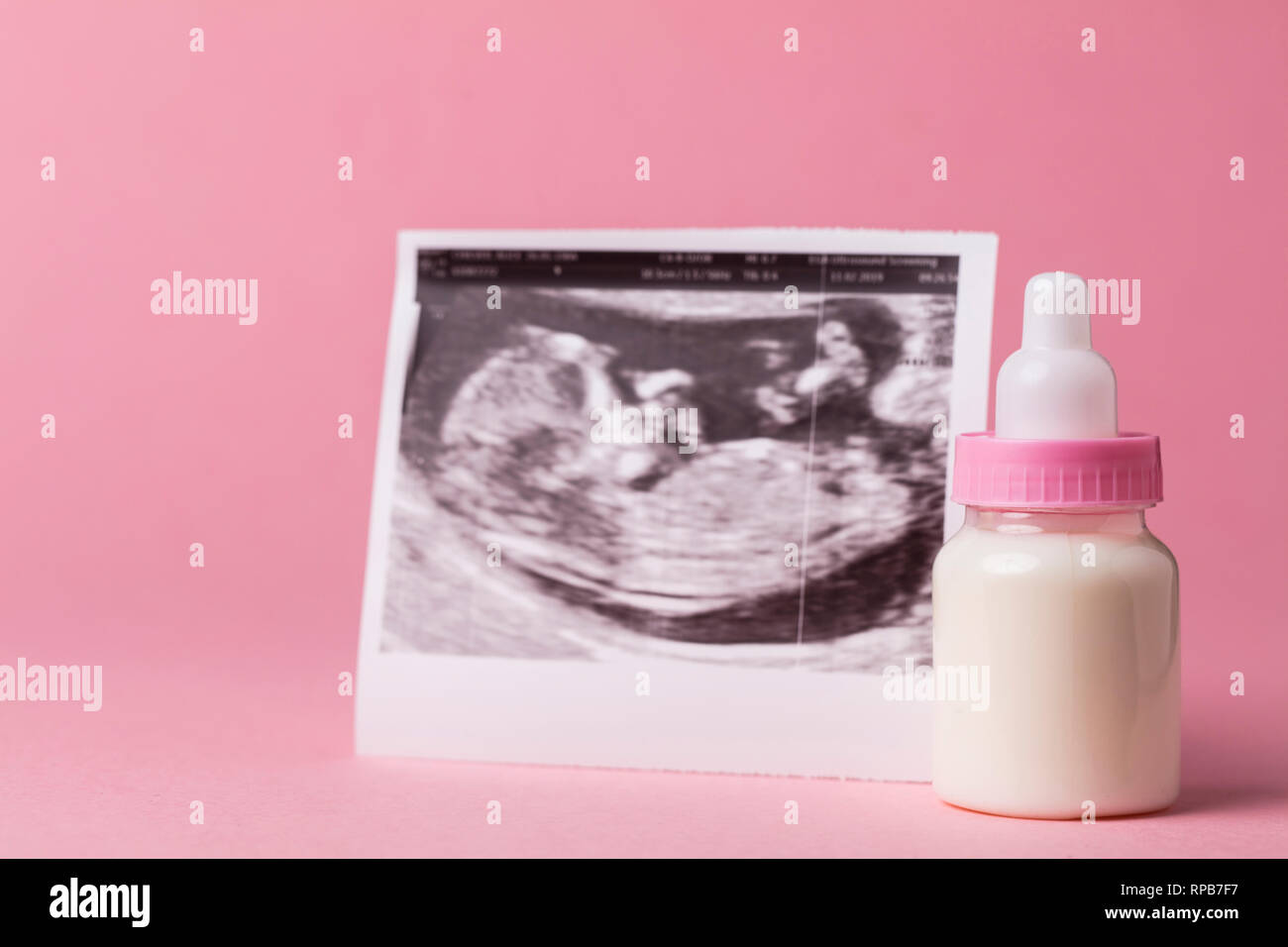 Baby scan ultrasound picture. Expectant parents concept Stock Photo - Alamy