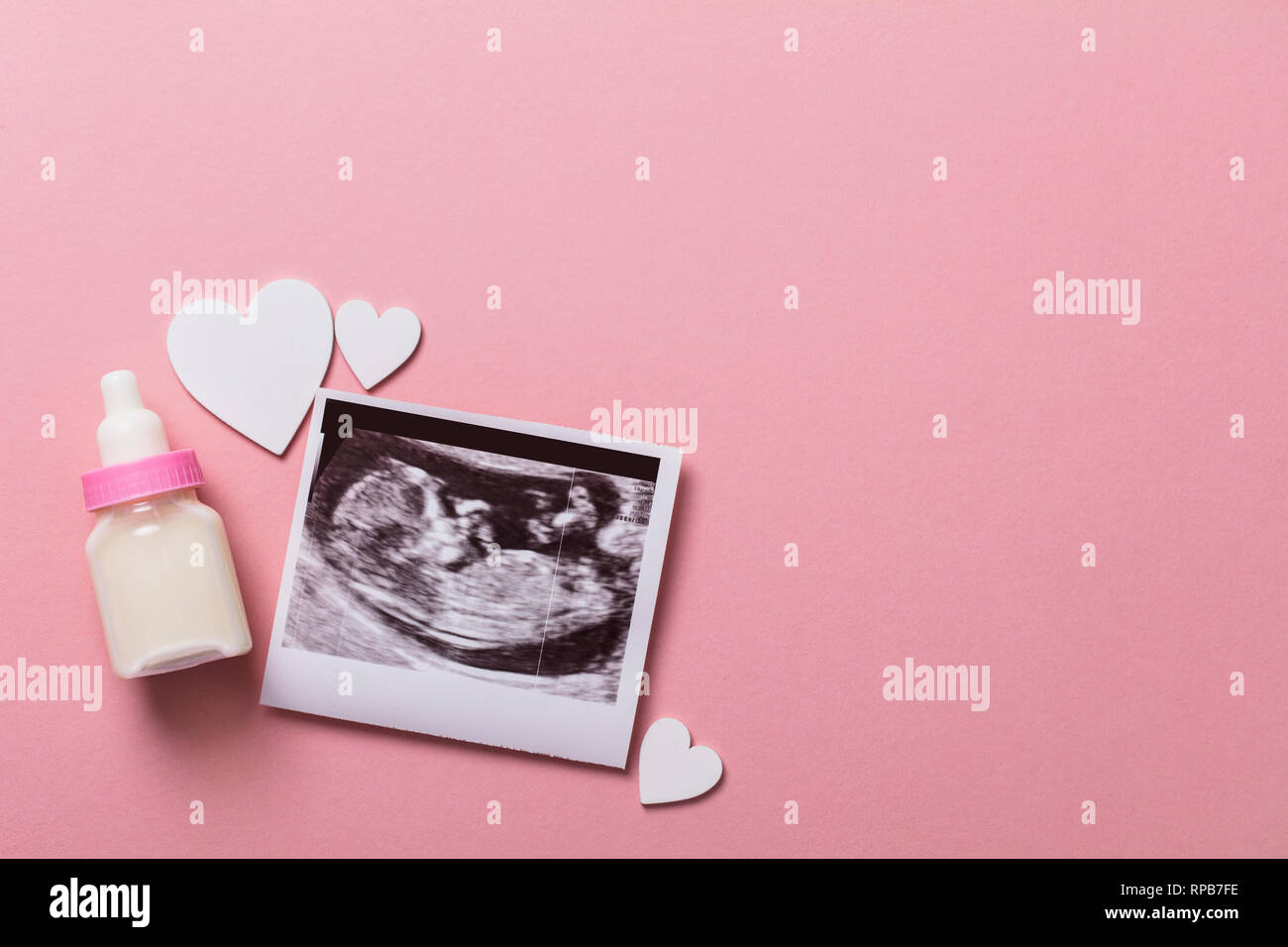 Baby scan ultrasound picture. Expectant parents concept Stock Photo - Alamy