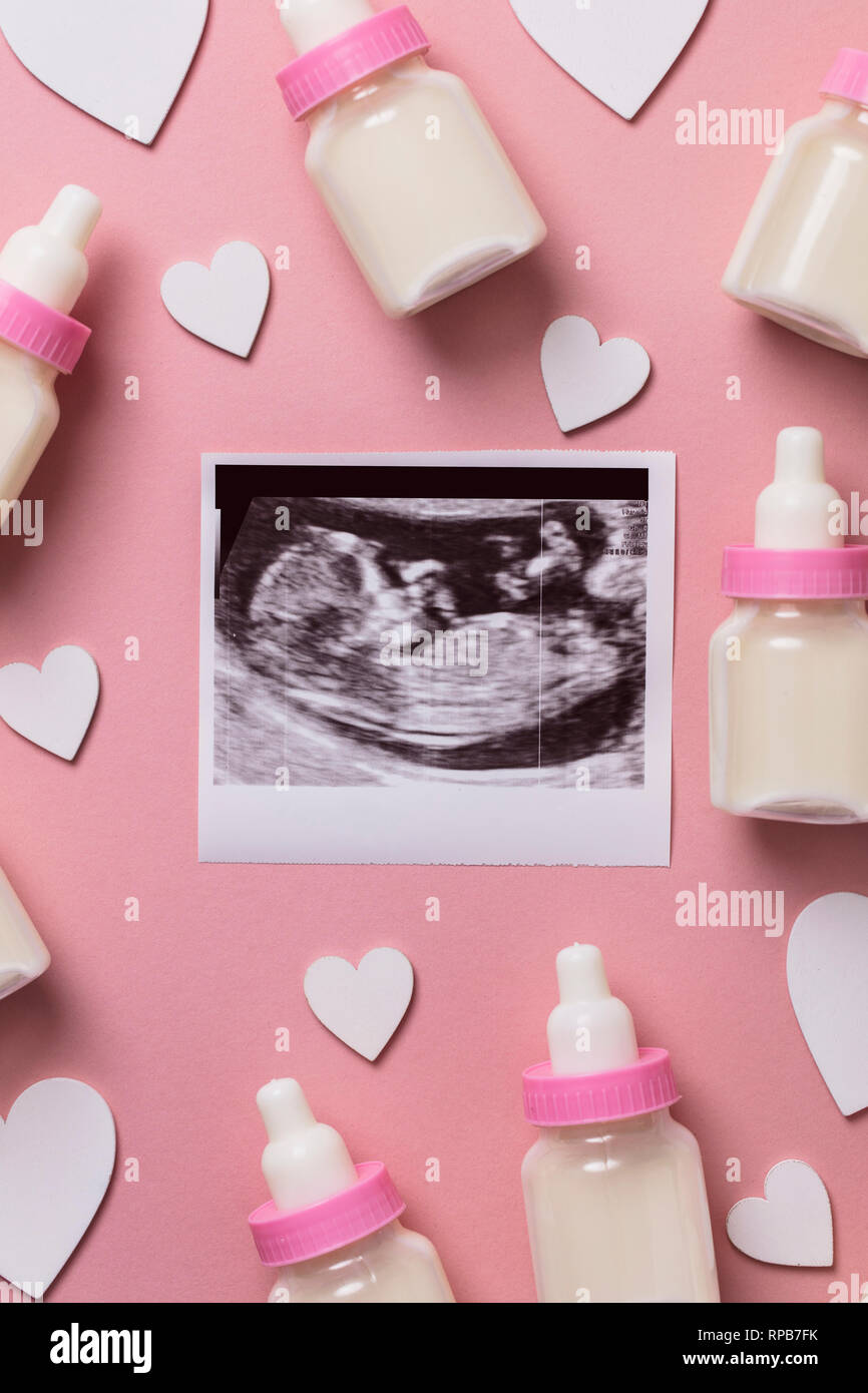 Baby scan ultrasound picture. Expectant parents concept Stock Photo - Alamy