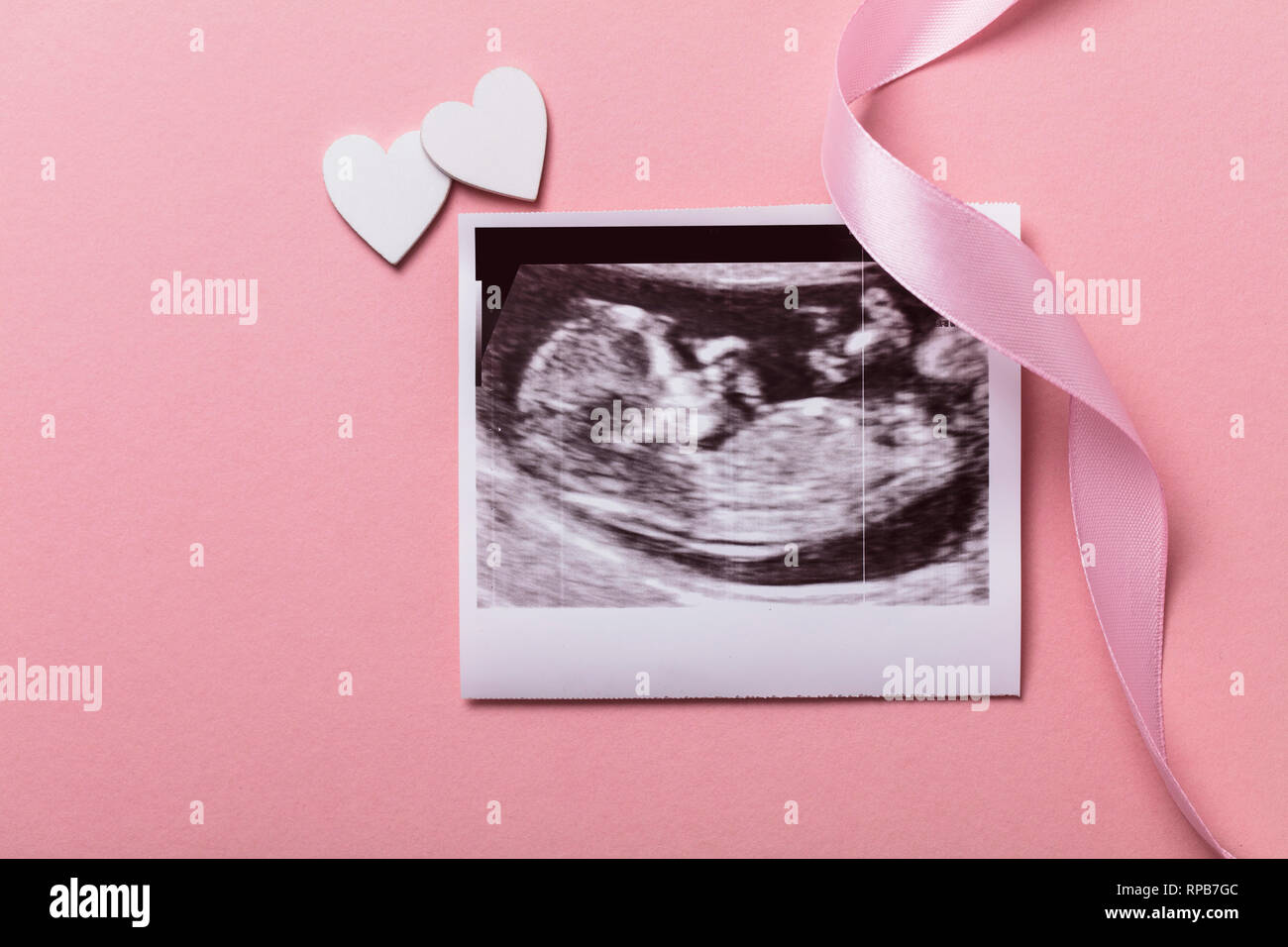 Baby Growth Scan High Resolution Stock Photography and Images - Alamy