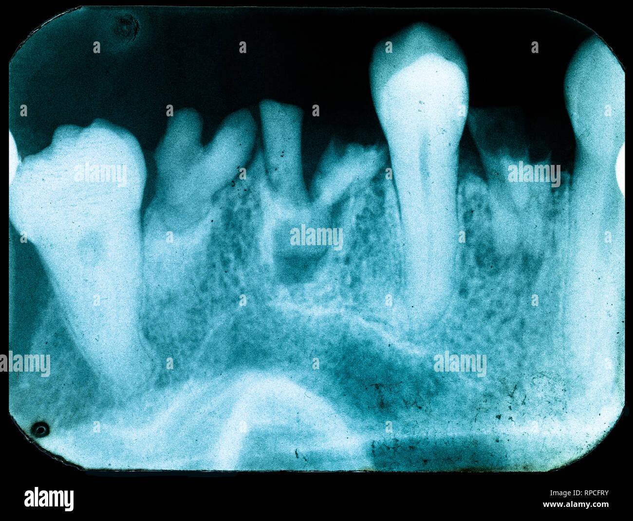 Old Dental x-ray with teeth in bad condition Stock Photo - Alamy