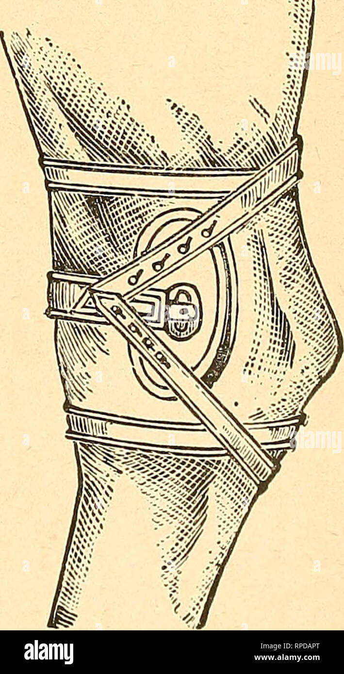 Bog spavin horse hi-res stock photography and images - Alamy