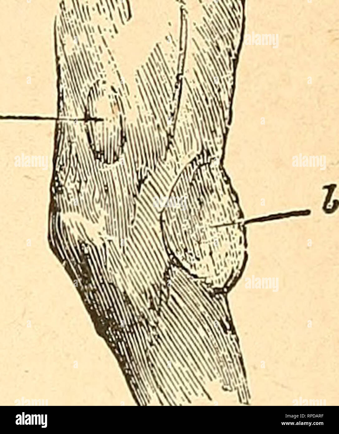 Joint secretion hi-res stock photography and images - Alamy