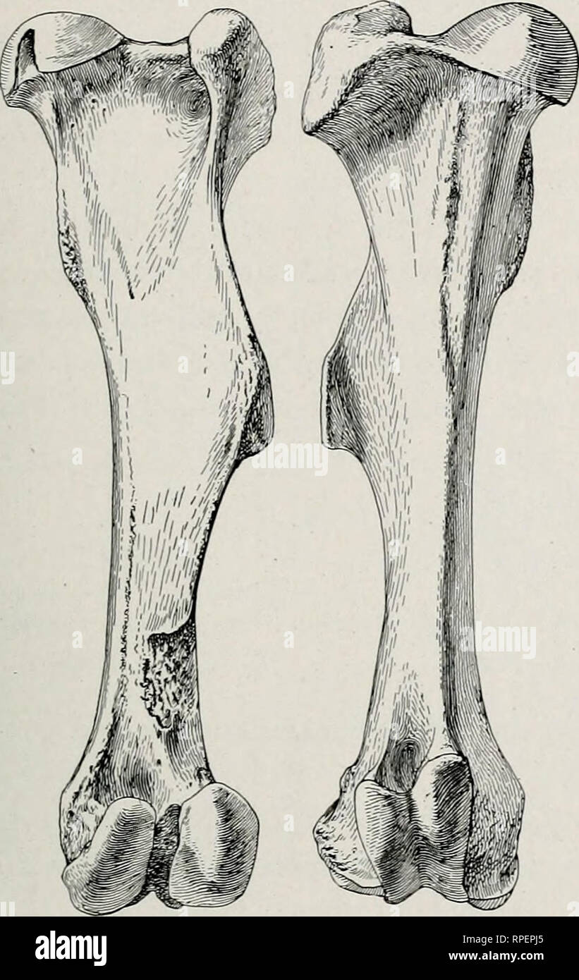 Cotyloid ligament hi-res stock photography and images - Alamy