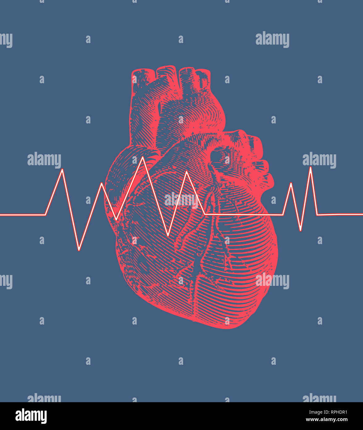 Heart surgery vintage hi-res stock photography and images - Alamy