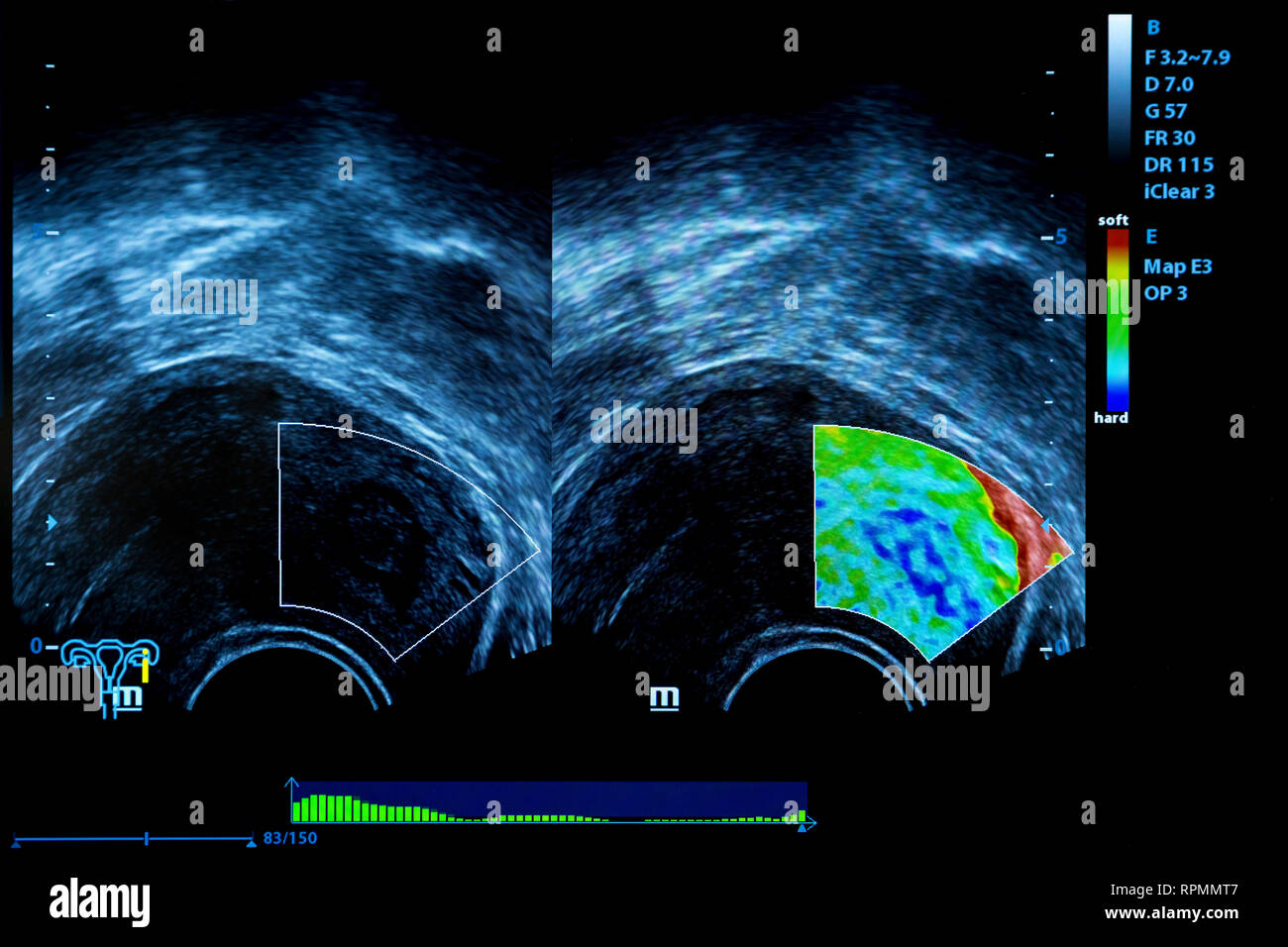 Colourful image of modern ultrasound monitor. Ultrasonography machine ...