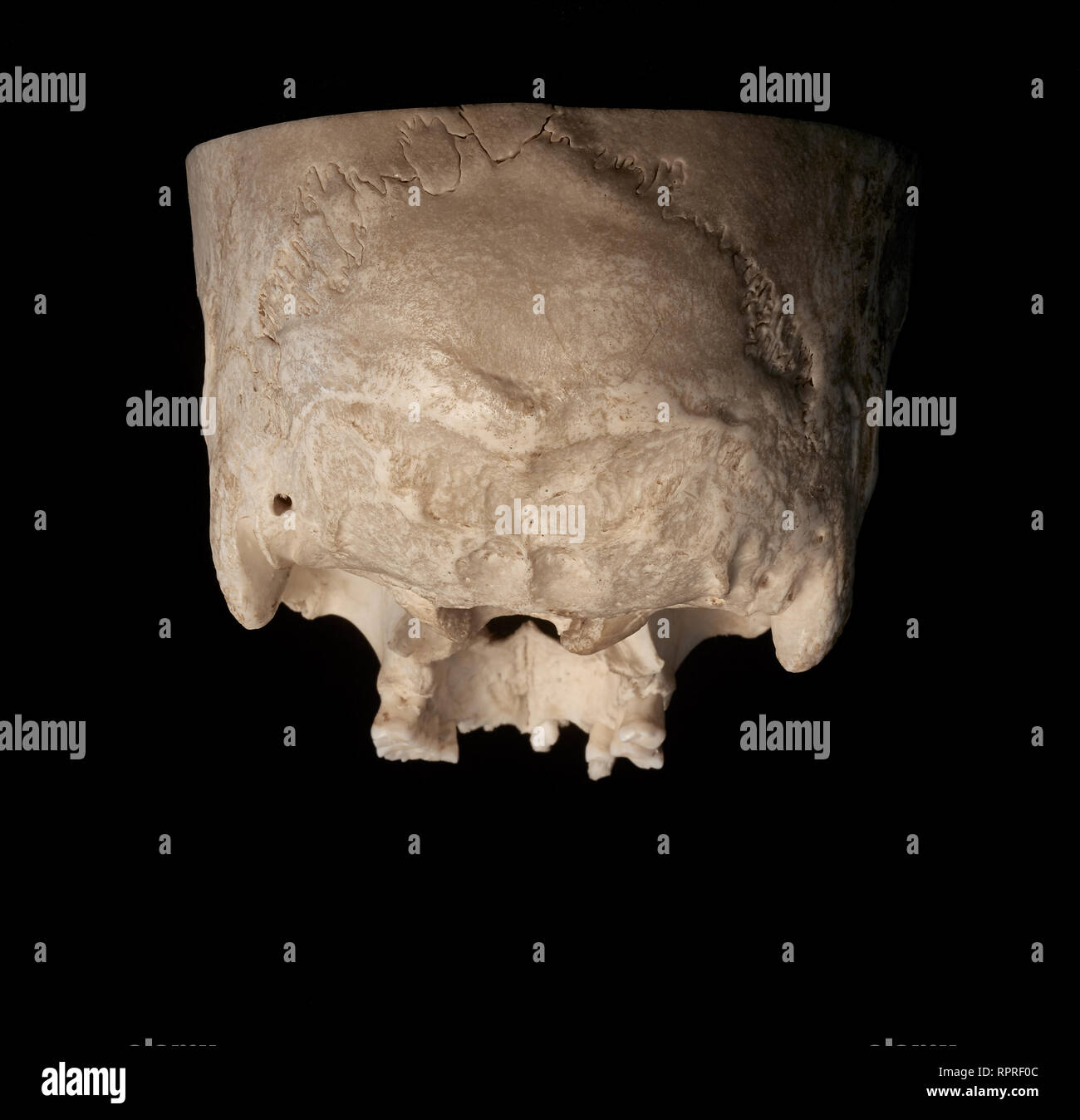 Anatomy human skull rear view hi-res stock photography and images - Alamy