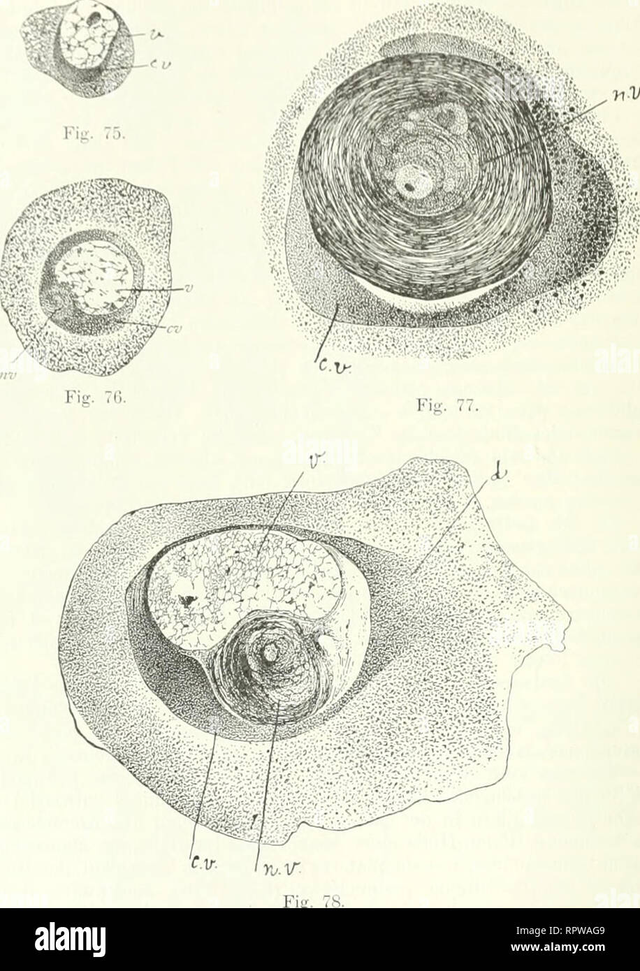 Stadium der entwicklung hi-res stock photography and images - Alamy