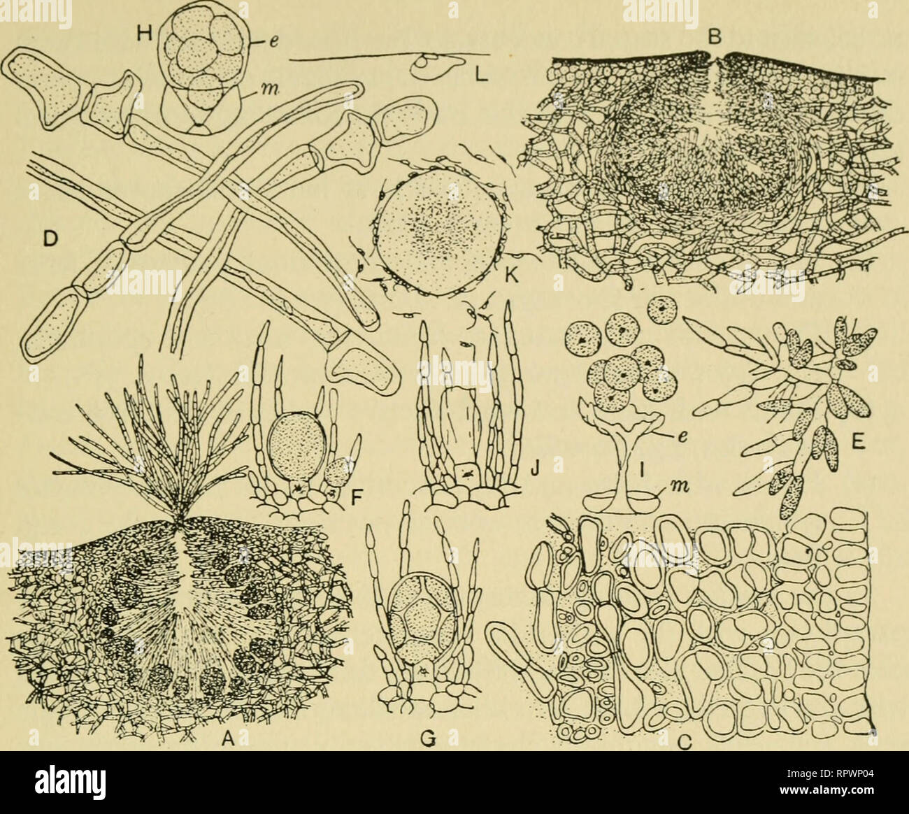 J spiralis hi-res stock photography and images - Alamy