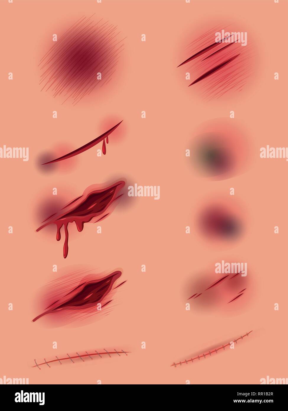 Skin wound Stock Vector Images - Alamy