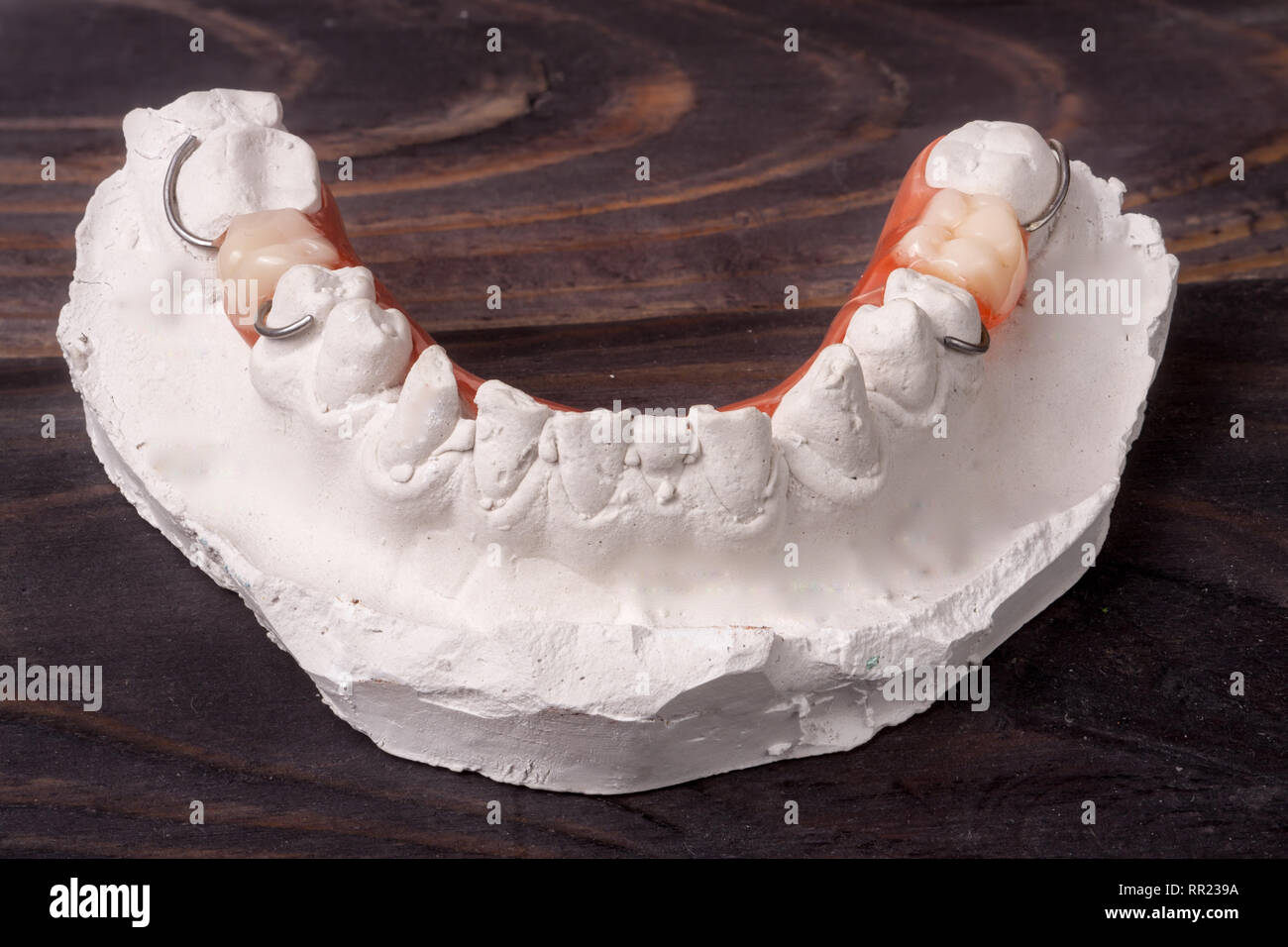 plaster cast of teeth with removable partial denture on a dark wooden ...