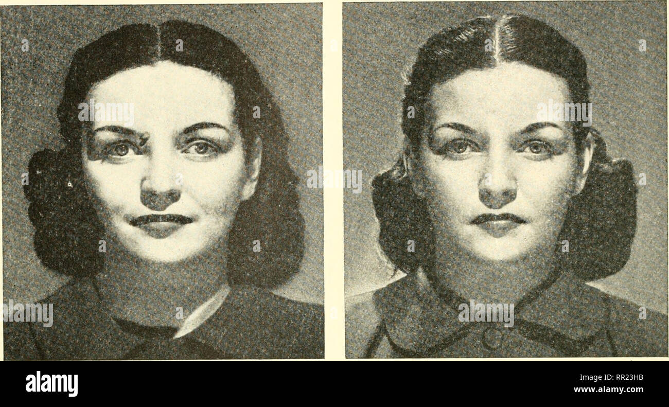 Identical twins difference hi-res stock photography and images - Alamy