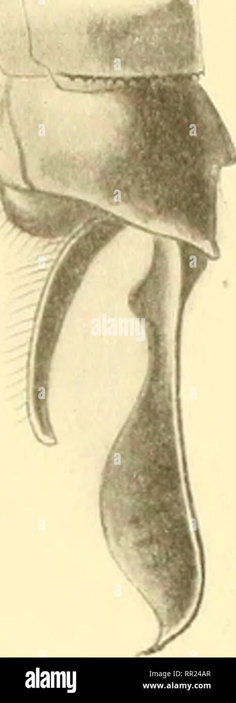 Occipital triangle hi-res stock photography and images - Alamy