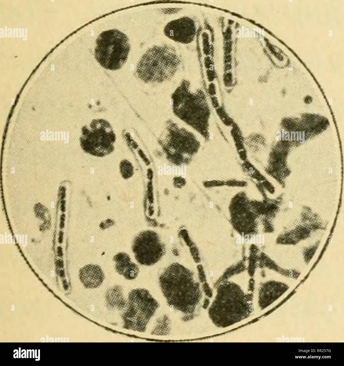 spirilla bacteria under microscope