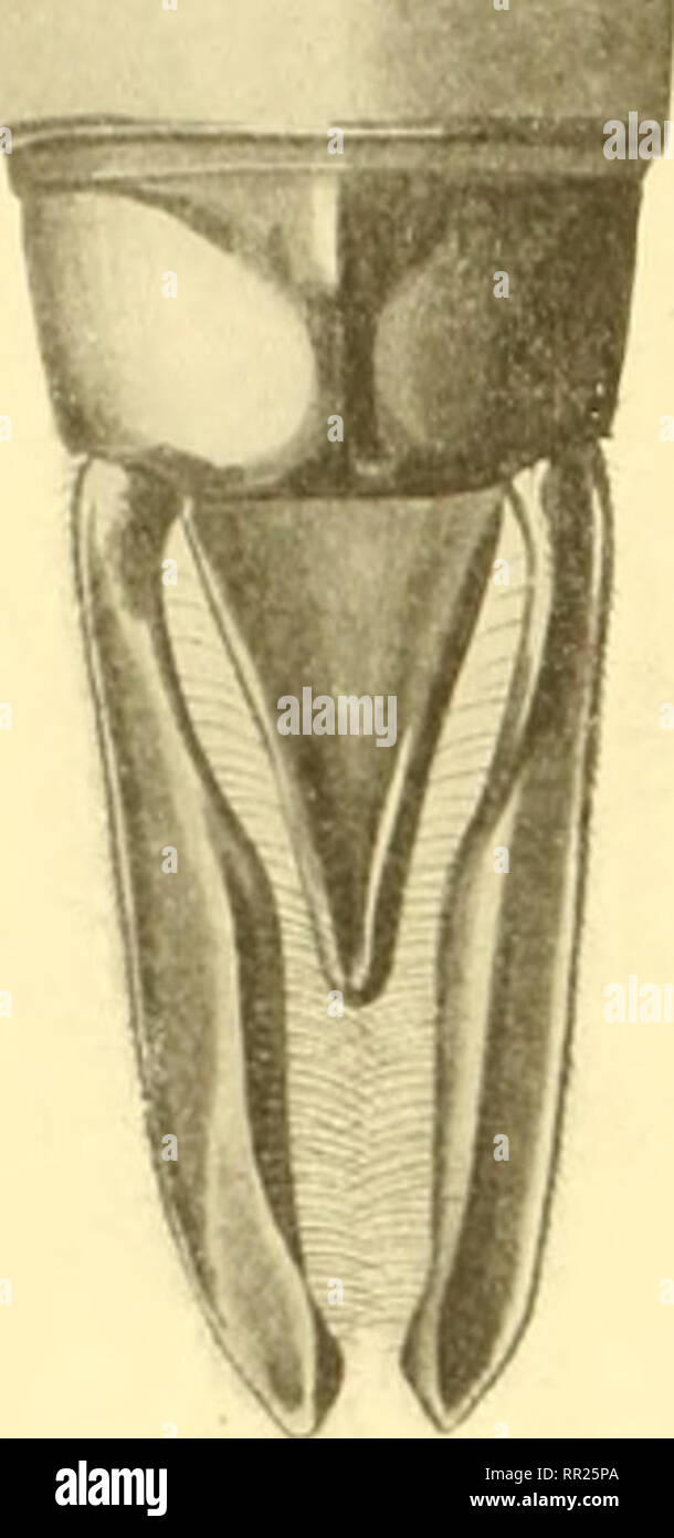 Occipital triangle hi-res stock photography and images - Alamy