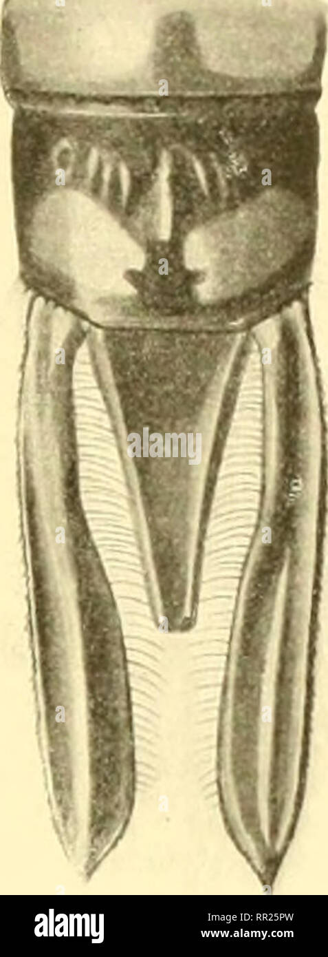 Occipital triangle hi-res stock photography and images - Alamy