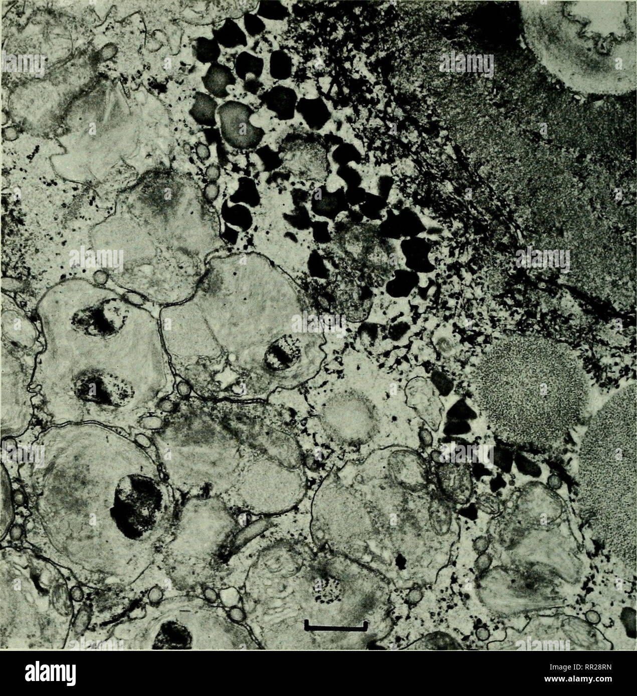 Chloroplast with starch hi-res stock photography and images - Alamy