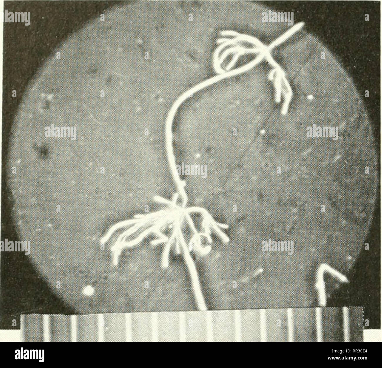 No melanin hi-res stock photography and images - Alamy