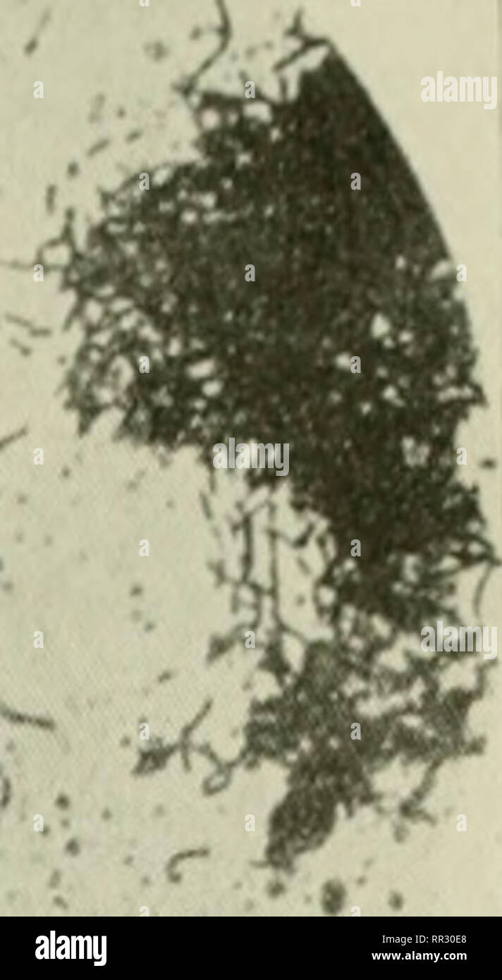 . The actinomycetes. Actinomycetales. Figure 98. Stained dental scum ...