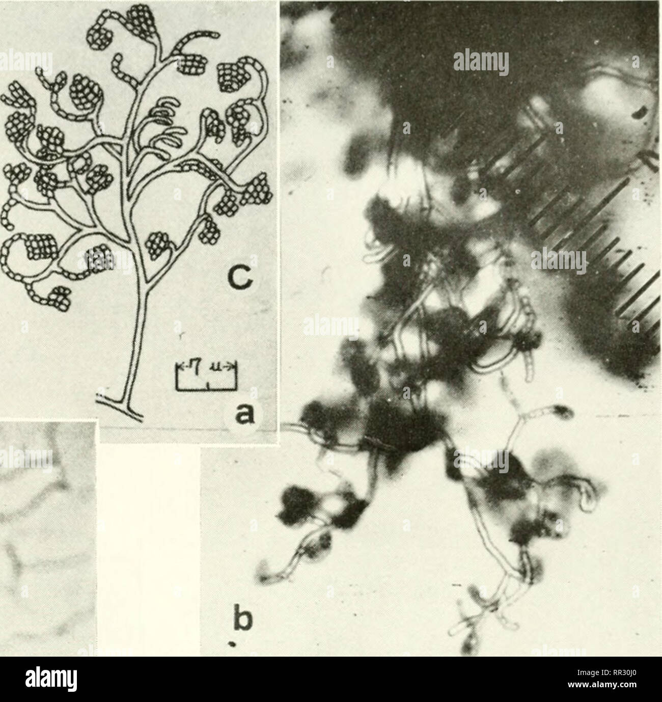 Actinomycetes High Resolution Stock Photography and Images - Alamy