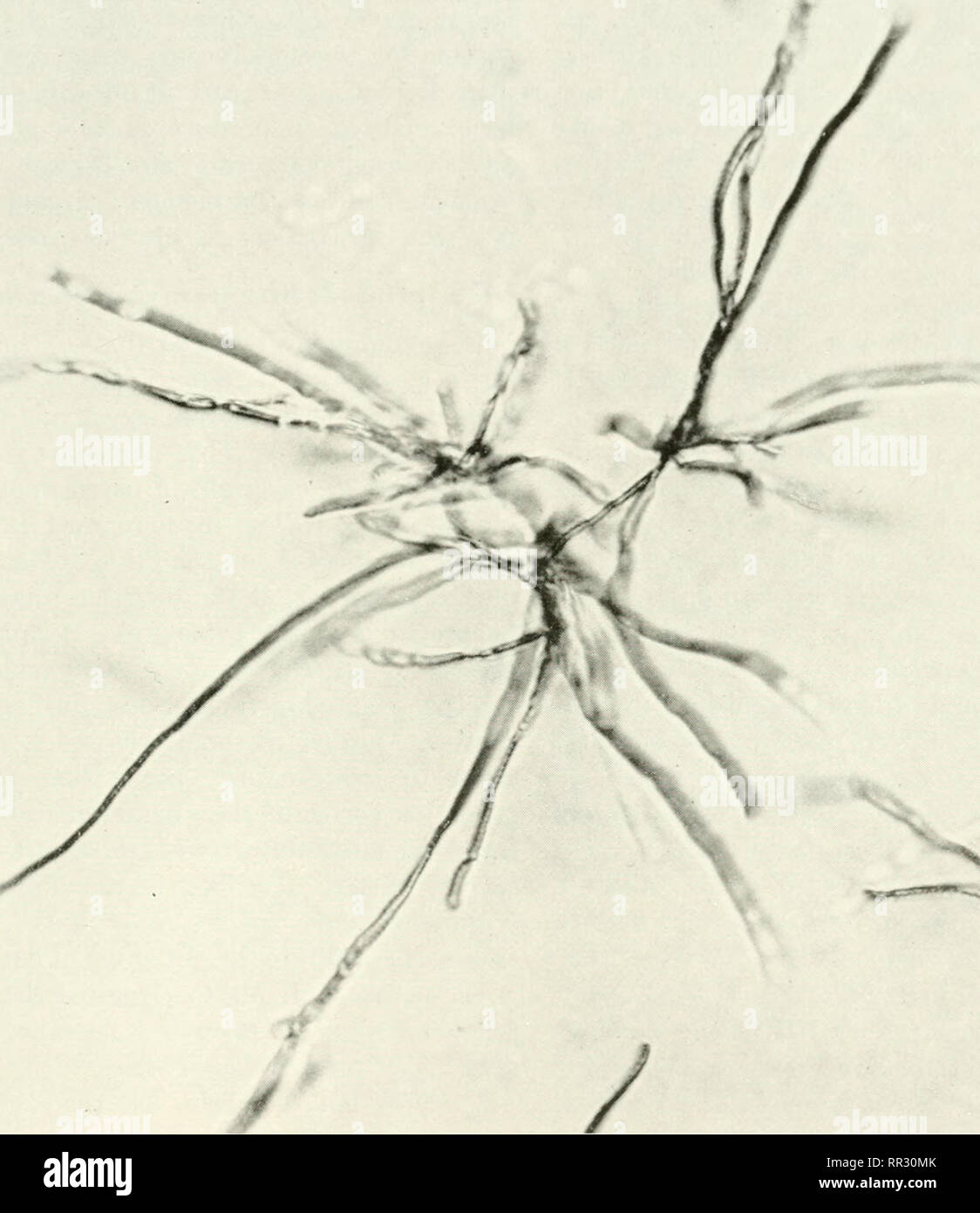 Streptomyces sp hi-res stock photography and images - Alamy