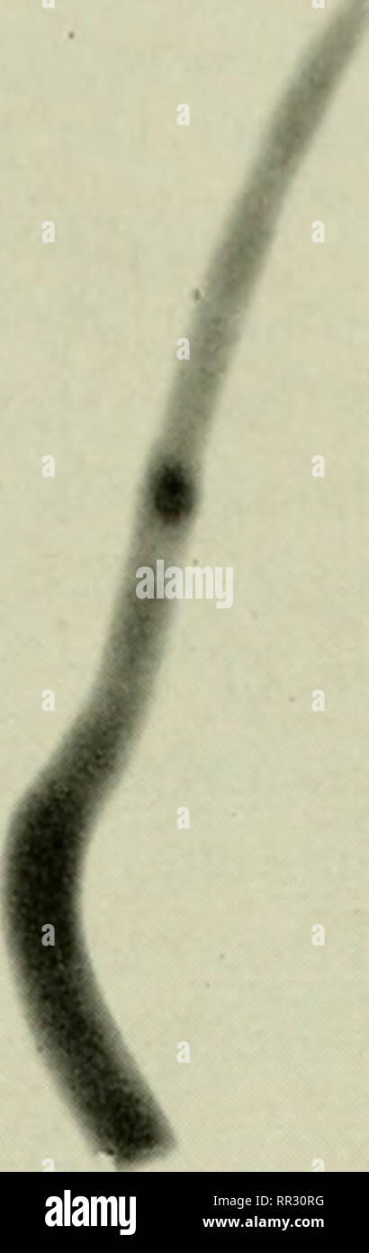 Streptomyces images hi-res stock photography and images - Alamy