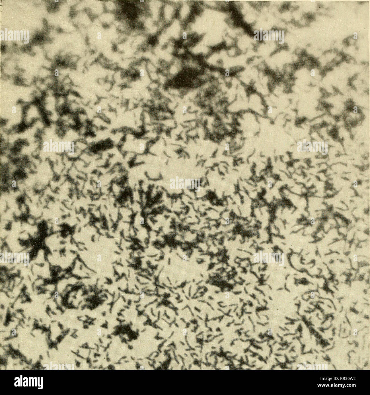 Nocardia asteroides hi-res stock photography and images - Alamy