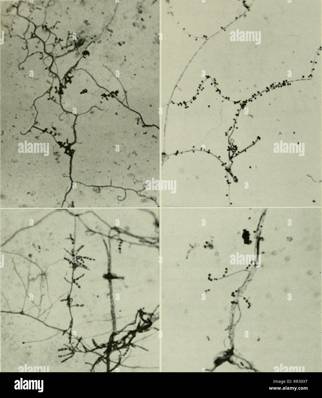 Soil actinomycetes hi-res stock photography and images - Alamy