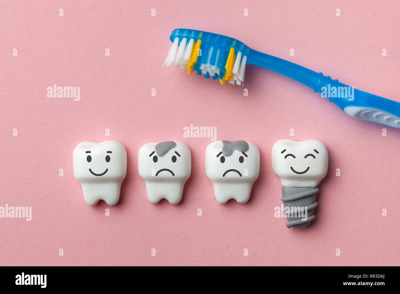 Healthy white teeth and implant are smiling and the tooth is sick with ...