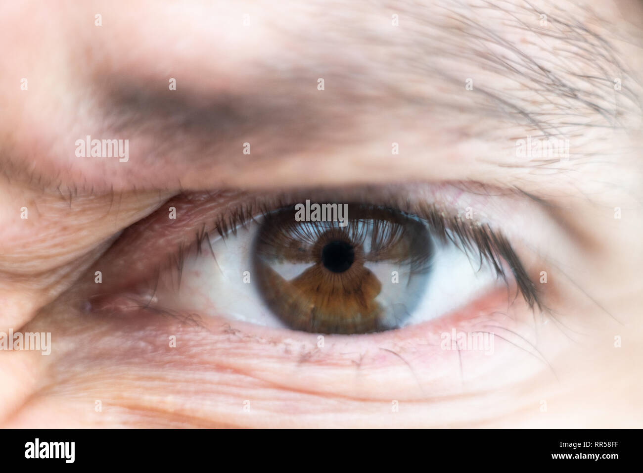 Squint Eye Stock Photos & Squint Eye Stock Images - Alamy