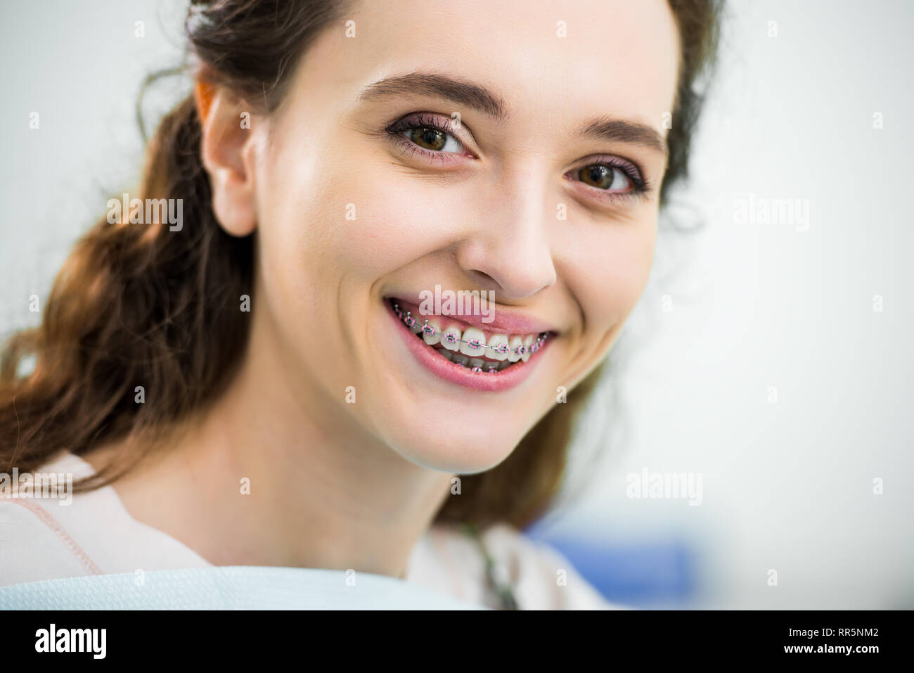 close up of happy woman with braces on teeth smiling in dental clinic ...