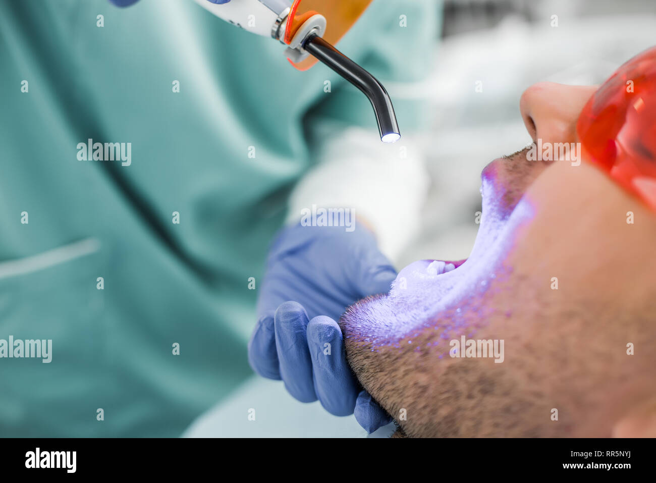 Bleaching procedure hi-res stock photography and images - Alamy