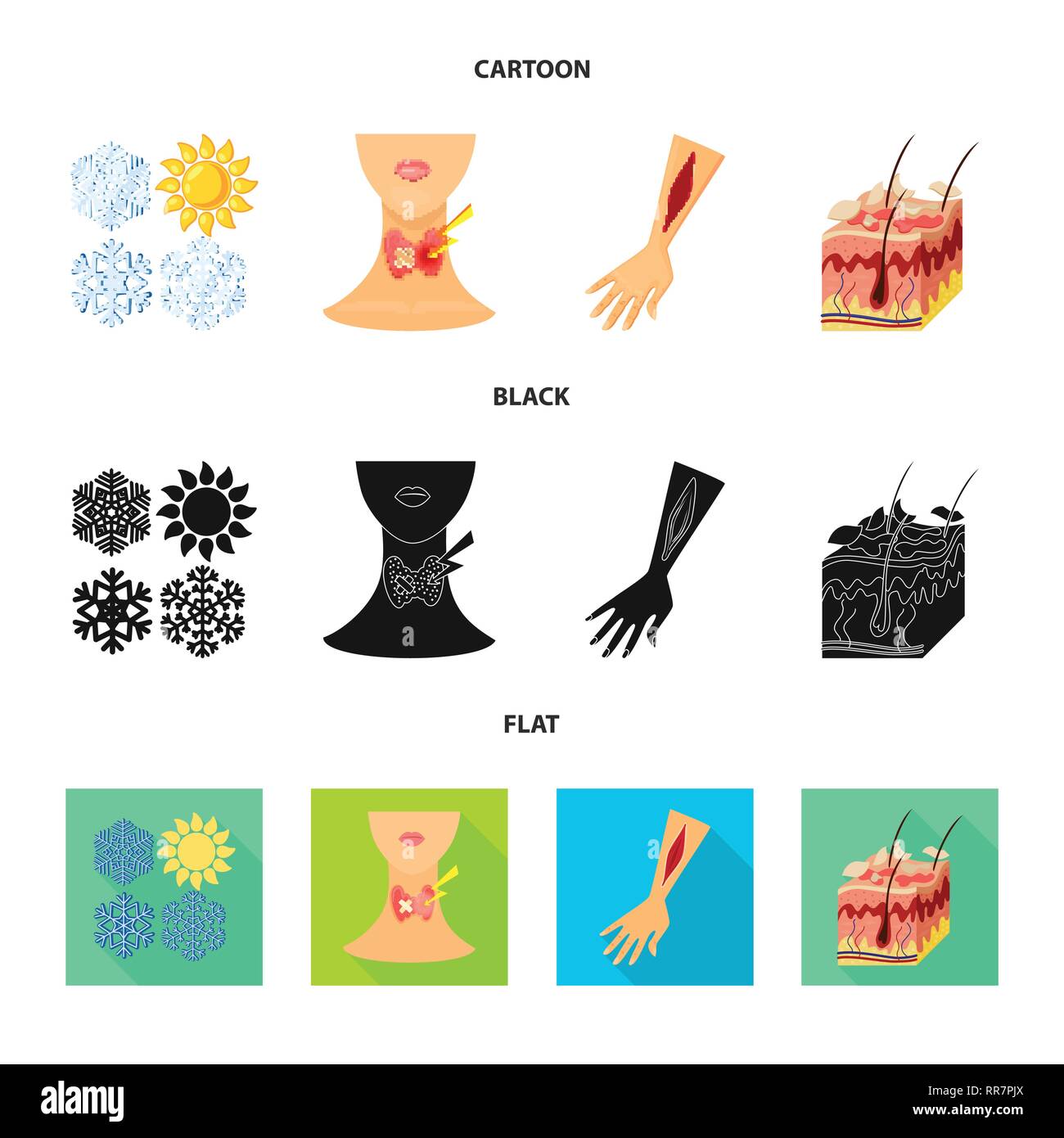 snowflake,endocrine,injury,skin,falling,system,arm,epidermis,ice,neck ...