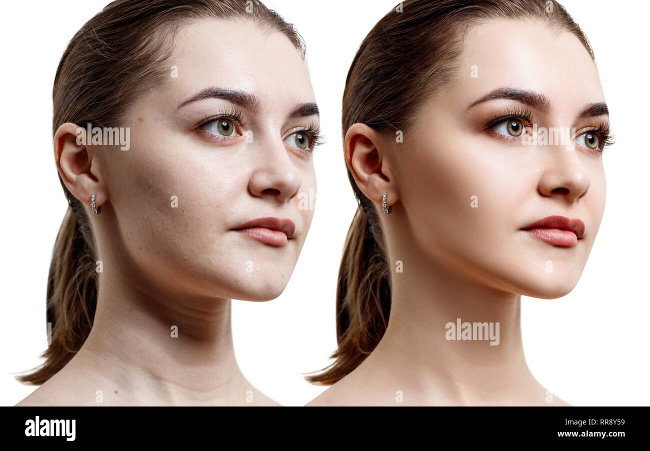 Comparison portrait of young woman before and after retouch Stock Photo ...