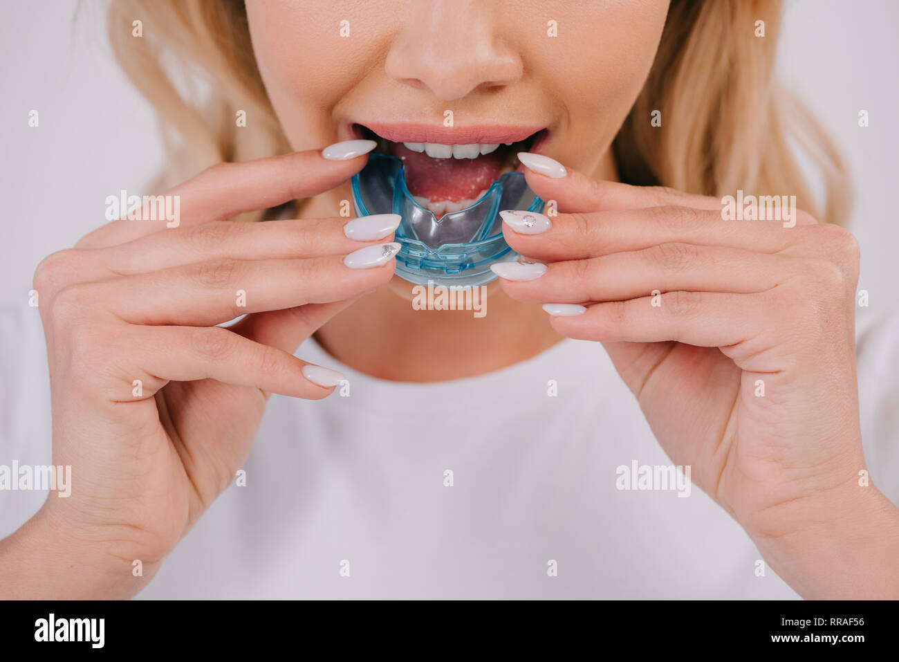 partial view of woman putting on orthodontic trainer dental braces ...