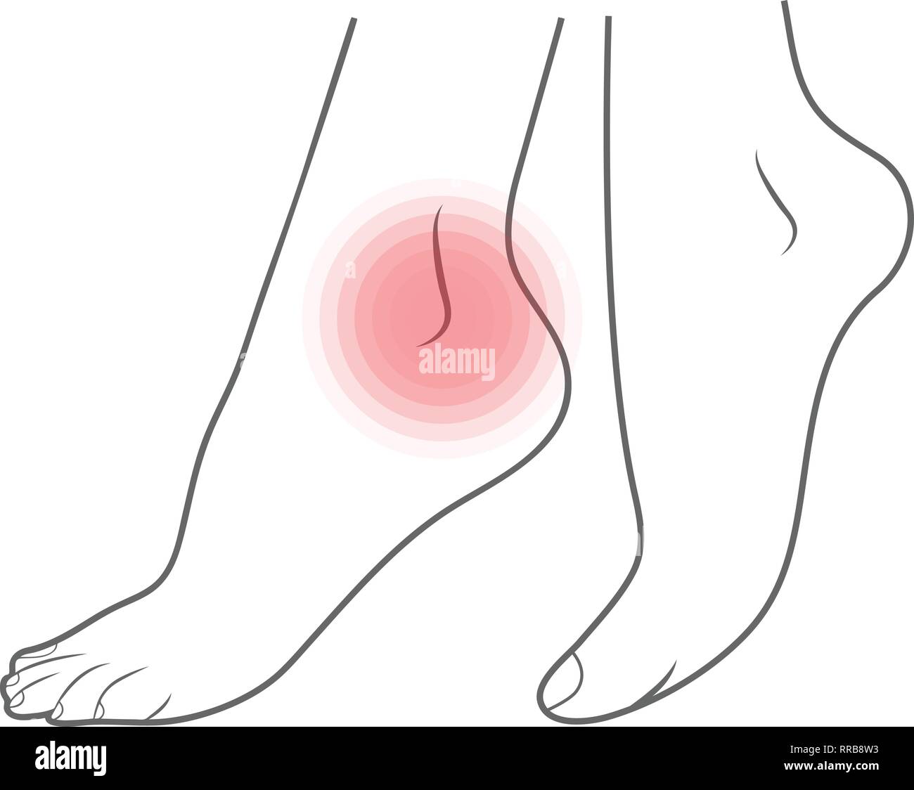 Man strain injury leg Stock Vector Images - Alamy