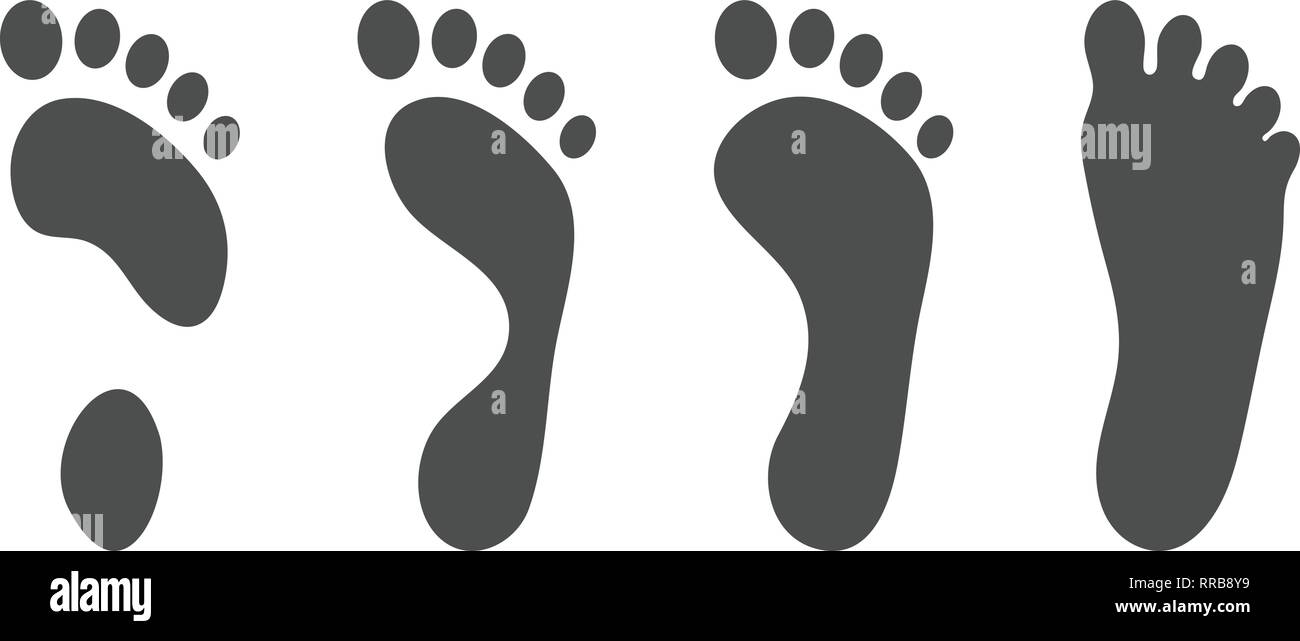 Foot Pathologies, Normal, Flat And Hollow Foot Isolated On A White ...