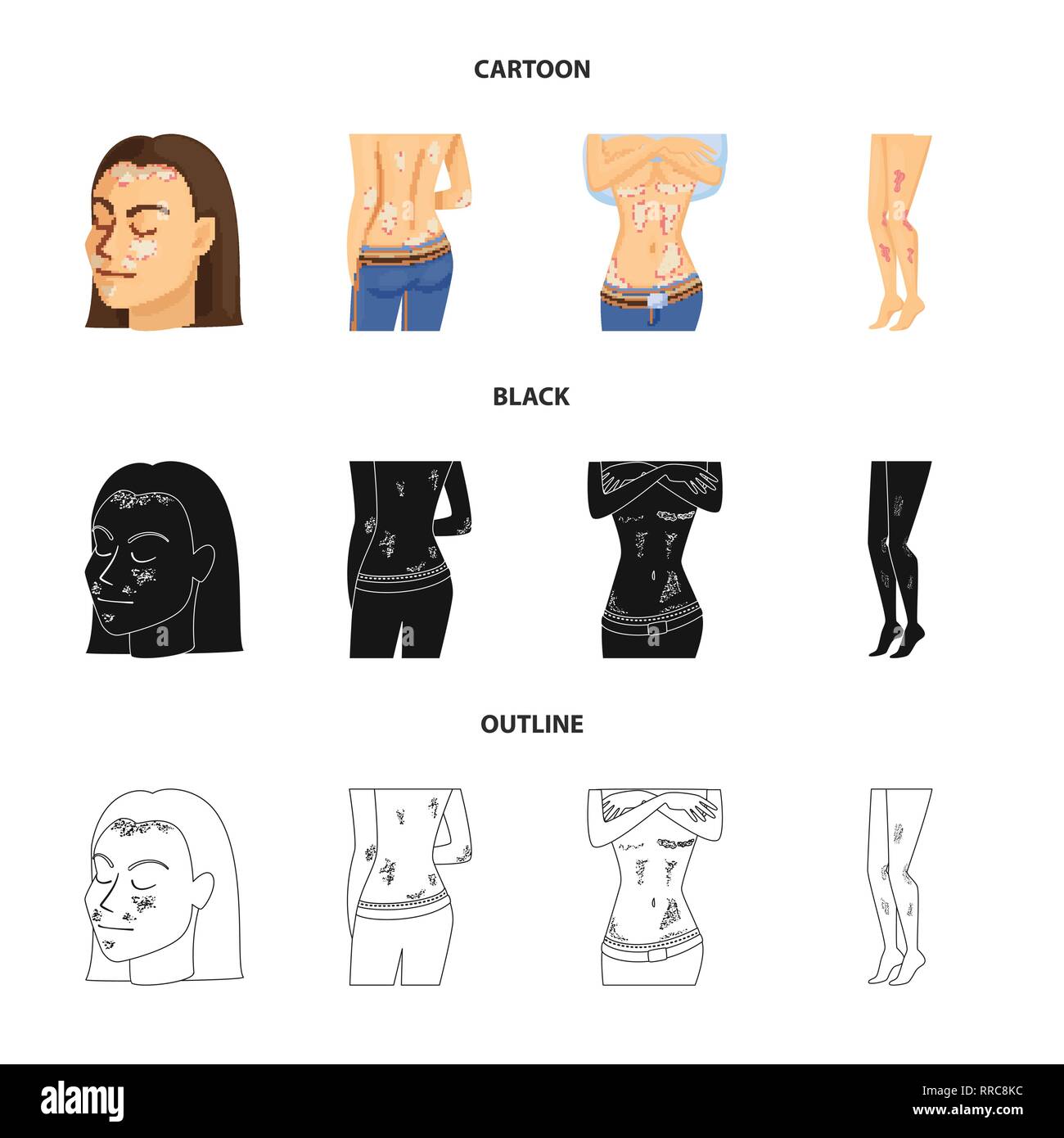 Skin rash back Stock Vector Images - Alamy