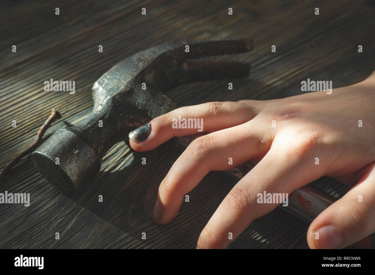 Injured hand with blackened and bruised thumbnail from bashing it ...