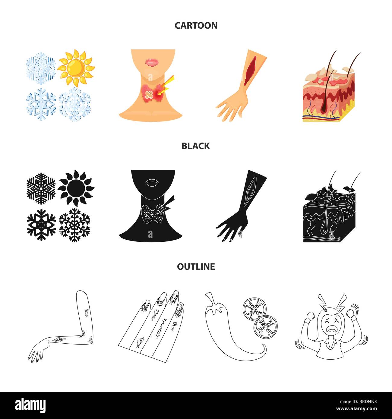 snowflake,endocrine,injury,skin,falling,system,arm,epidermis,ice,neck ...