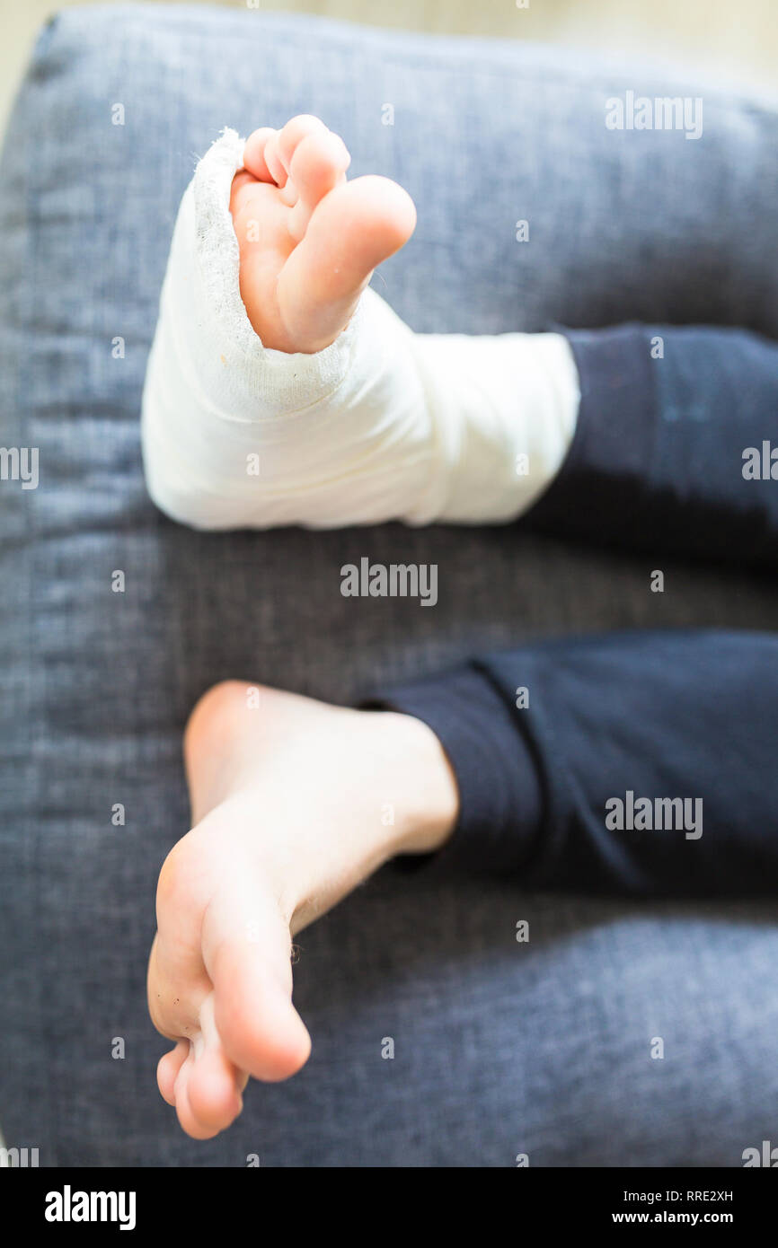 Plaster Leg Cast Legs Stock Photos & Plaster Leg Cast Legs Stock Images ...