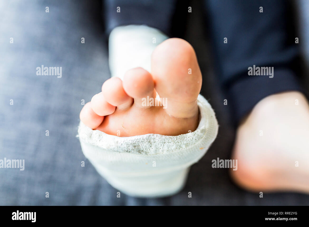 Patient broken leg in plaster hi-res stock photography and images - Alamy